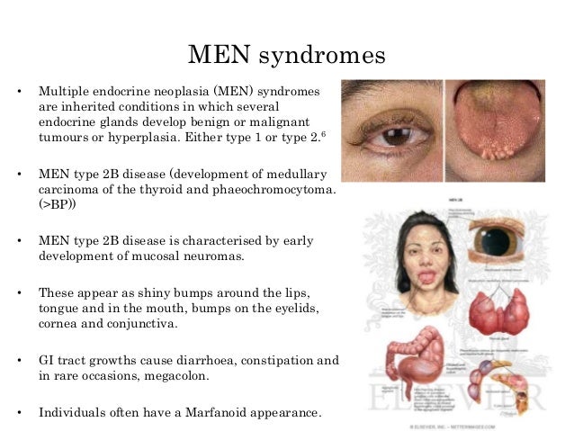 Cutaneous presentation of tumours