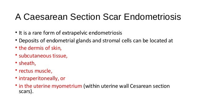 Cutaneous cesarean scar endometriosis