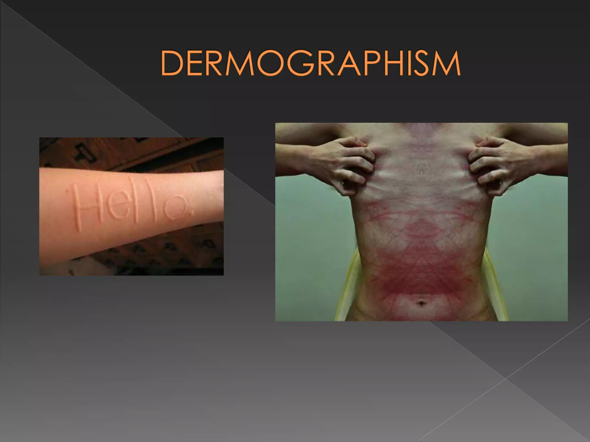 Cutaneous circulation & splanchnic circulation | PPTX