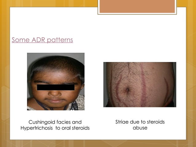 Cutaneous Drug eruptions (part-2).pptxcc | PPT