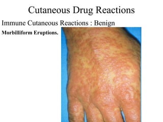 Cutaneous drug reactions | PDF