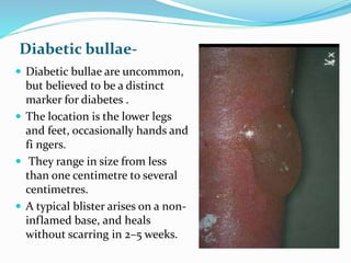Cutaneous features of endocrine diseases | PPTX