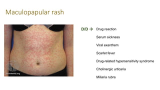 Cutaneous id reaction derma ppt dermatophytosis | PPTX