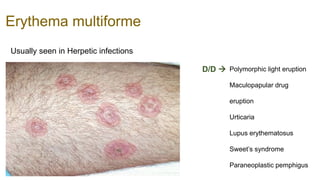 Cutaneous id reaction derma ppt dermatophytosis | PPTX
