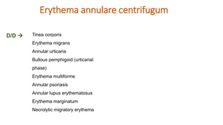Cutaneous id reaction derma ppt dermatophytosis | PPTX