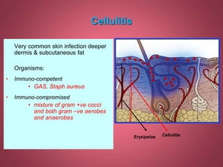 Cutaneous Infections of skin disease management | PPT