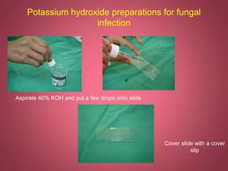 Cutaneous Infections of skin disease management | PPT