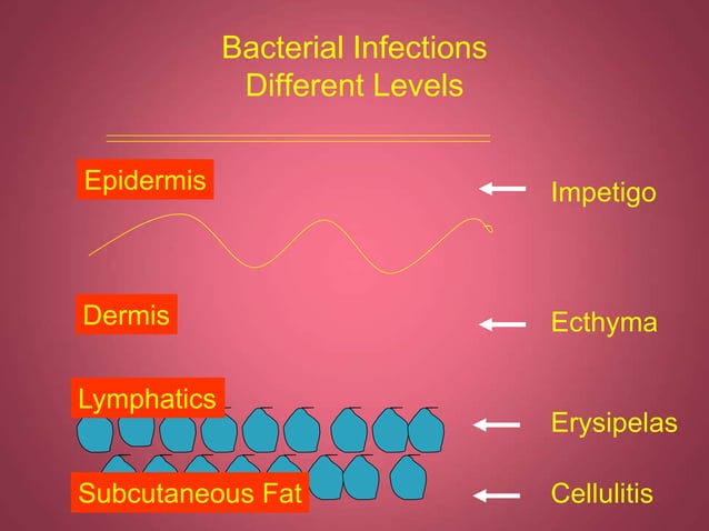Cutaneous Infections of skin disease management | PPT