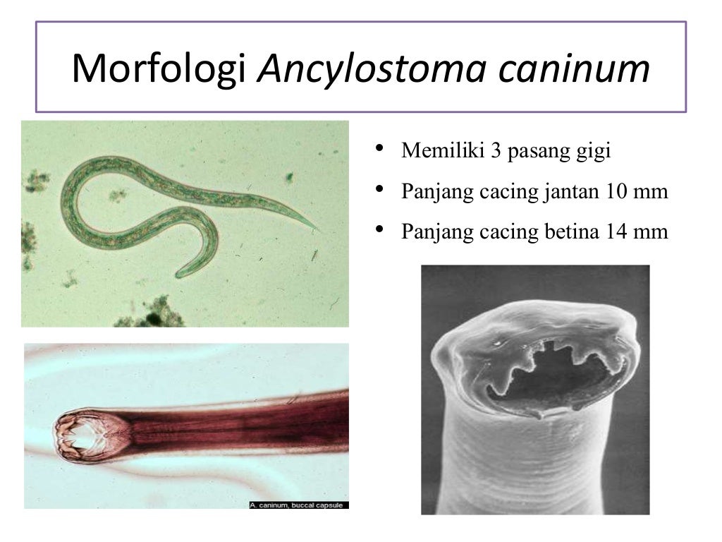 Cutaneous Larva Migrans