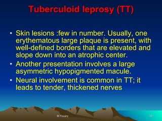 Cutaneous Leprosy | PPS