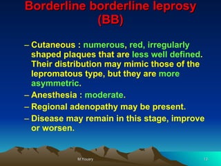 Cutaneous Leprosy | PPS