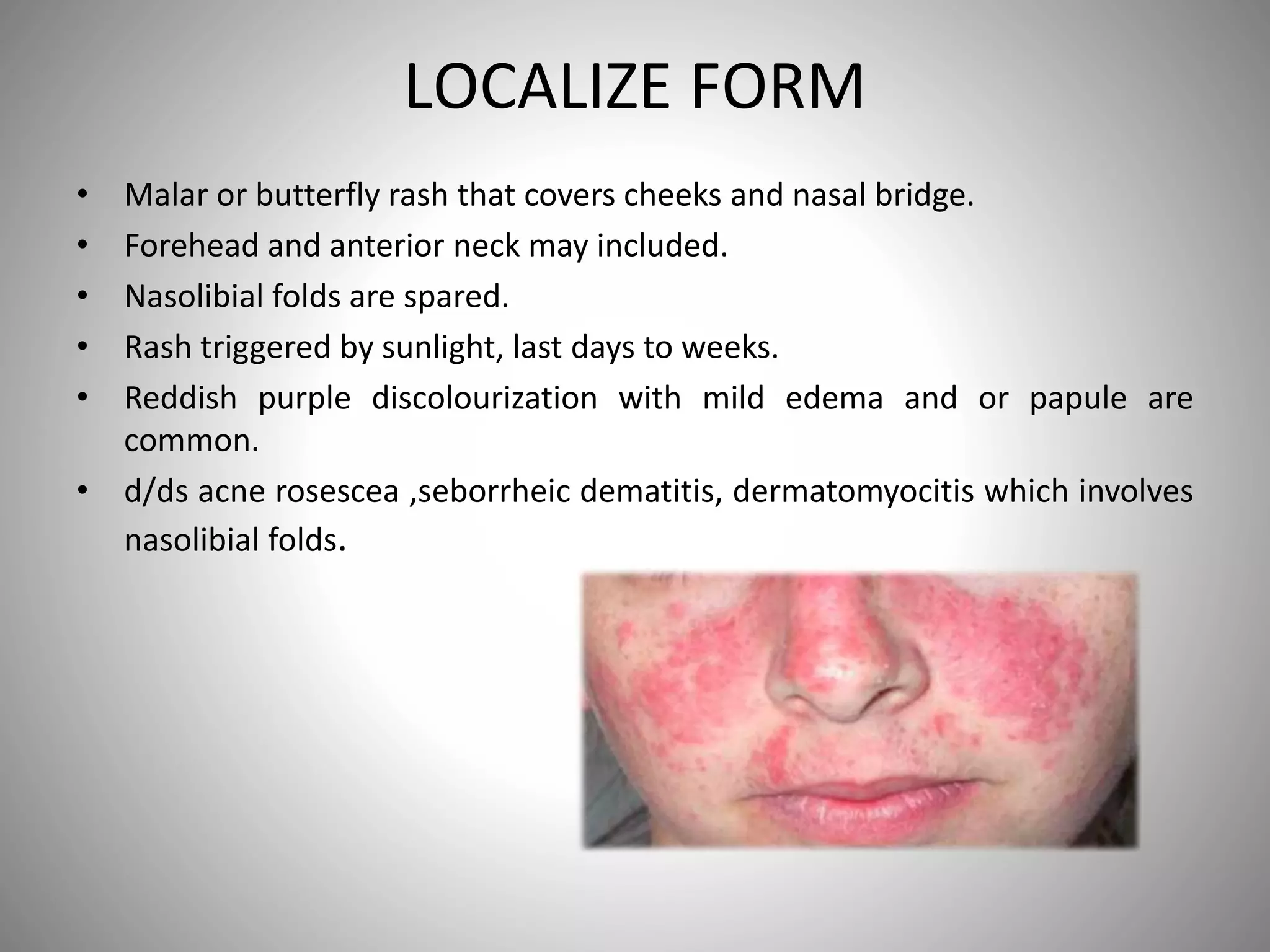 CUTANEOUS LUPUS ERYTHEMATOUS.pptx