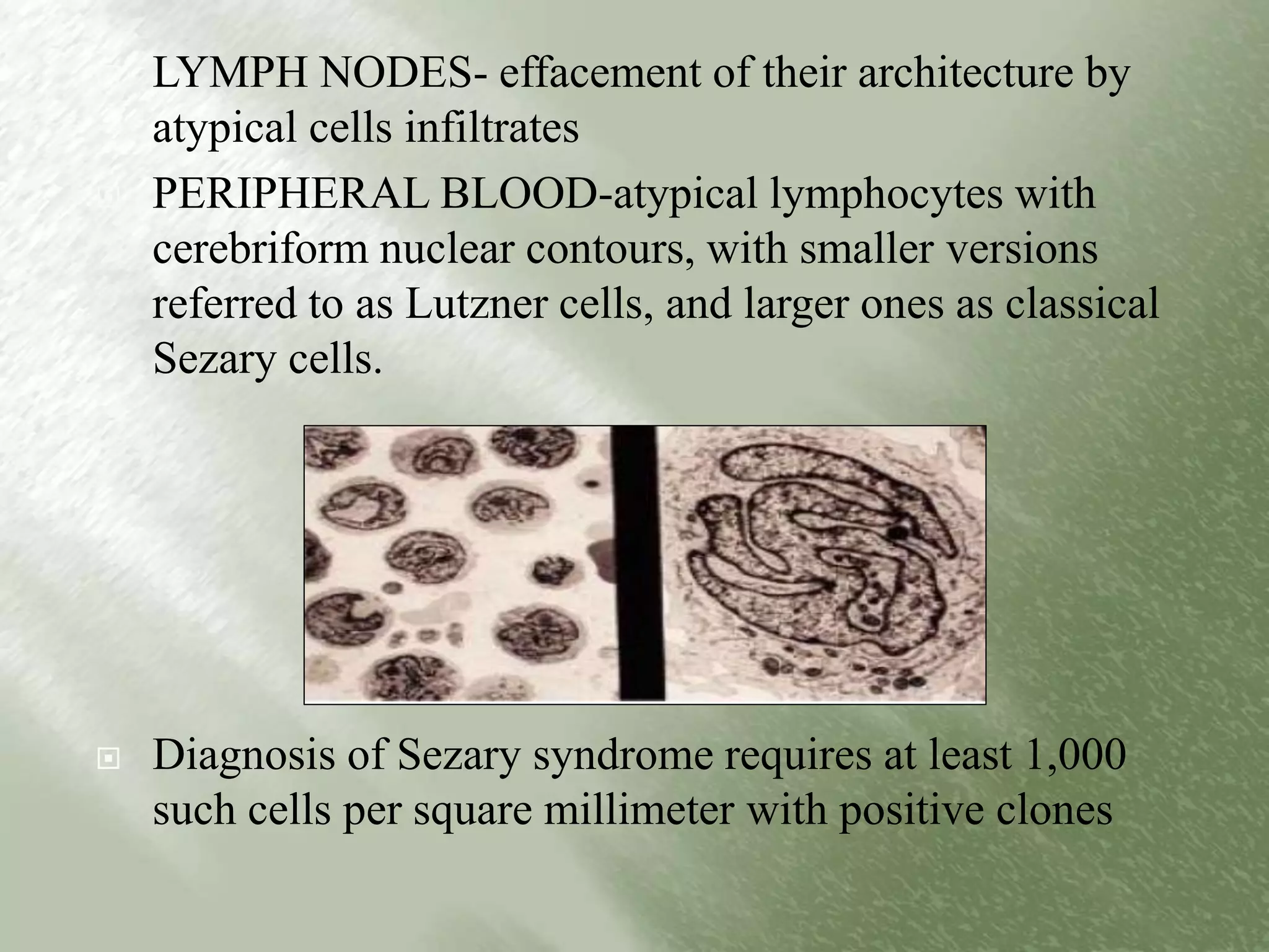 Cutaneous lymphoproliferative disorders | PPTX