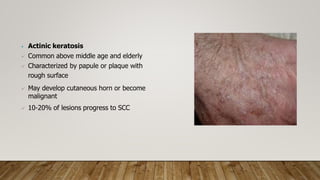 Cutaneous malignancies and related disorders.pptx