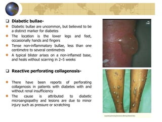 Cutaneous manifeatations in endocrine disorders | PPTX