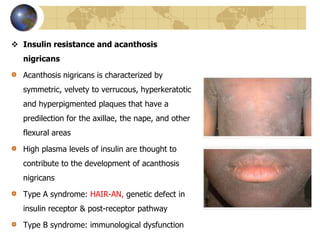 Cutaneous manifeatations in endocrine disorders | PPTX