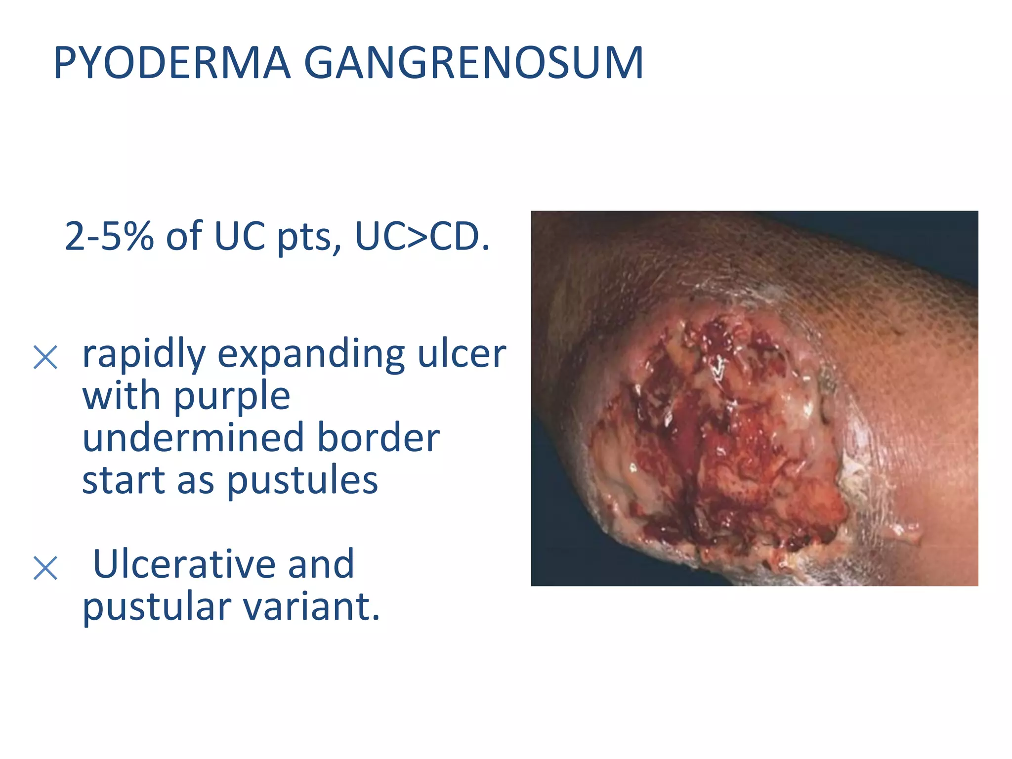 Cutaneous manifestation of gi | PDF