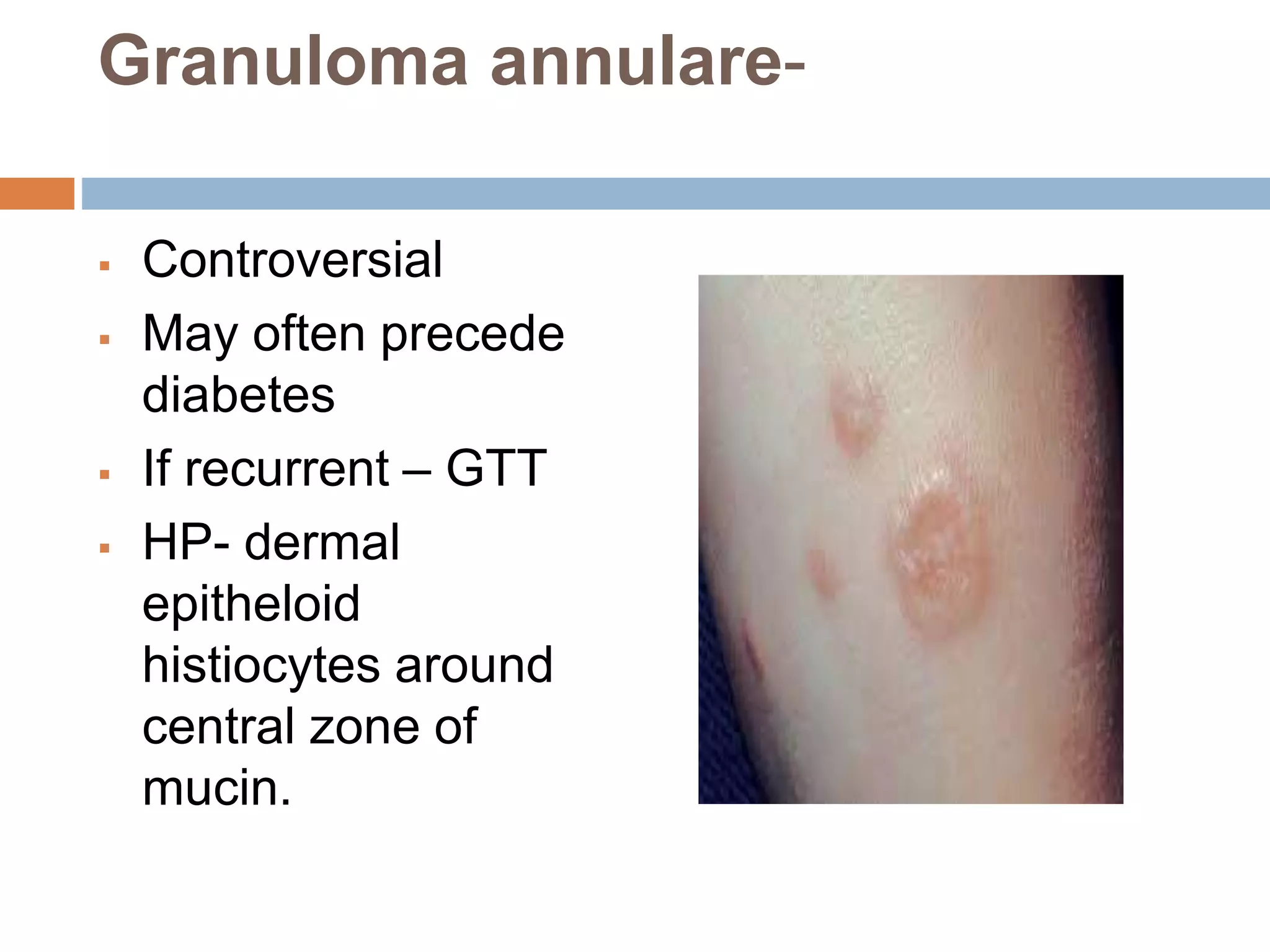Cutaneous manifestations of endocrine disease | PPTX