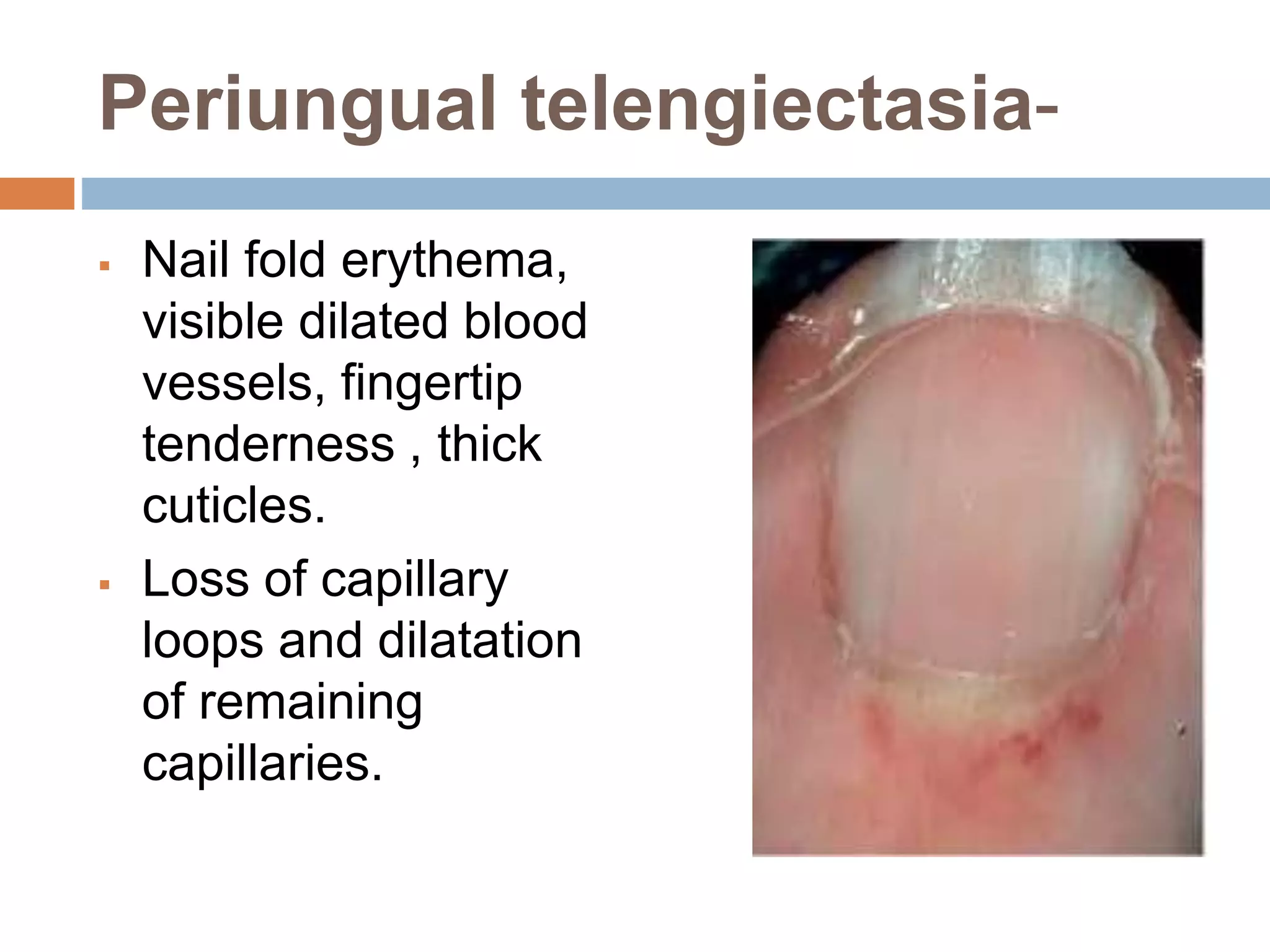 Cutaneous manifestations of endocrine disease | PPTX