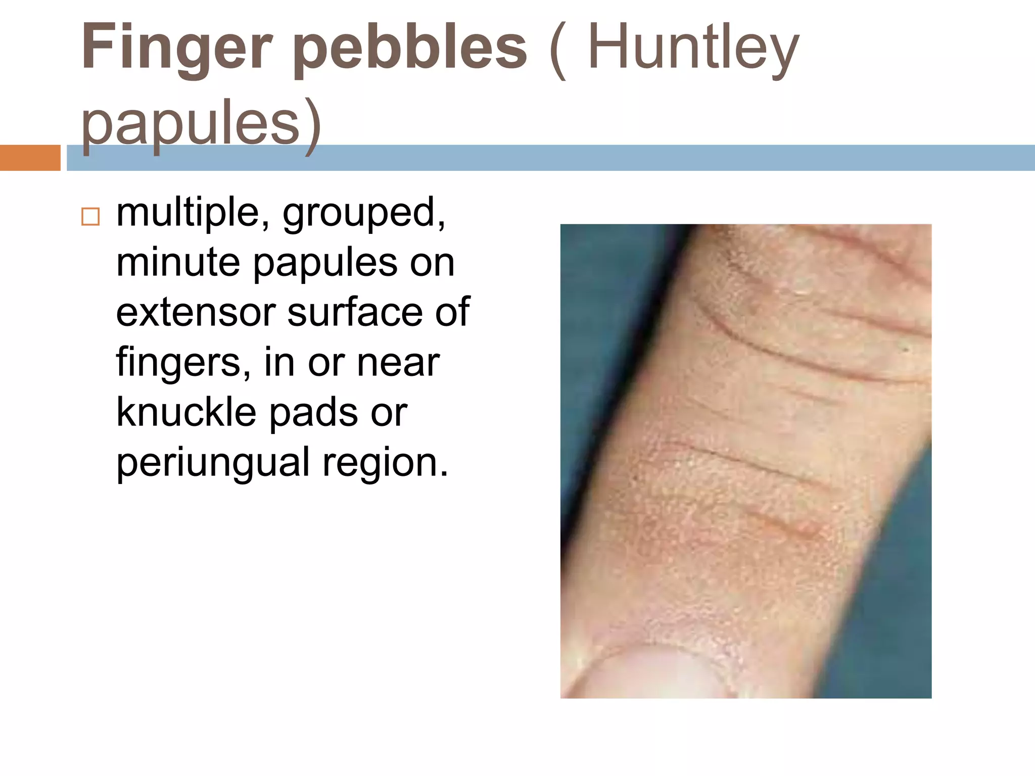 Cutaneous manifestations of endocrine disease | PPTX