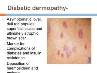 Cutaneous manifestations of endocrine disease | PPTX