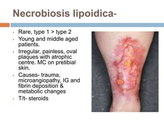 Cutaneous manifestations of endocrine disease | PPTX