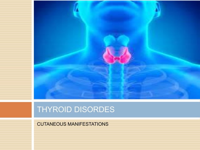 Cutaneous manifestations of endocrine disease | PPTX