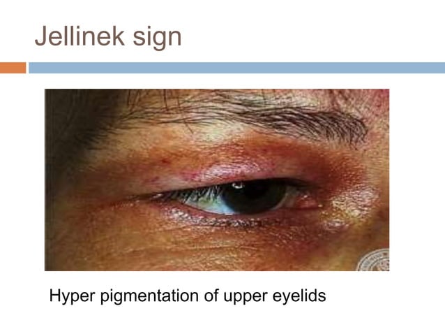 Cutaneous manifestations of endocrine disease | PPTX