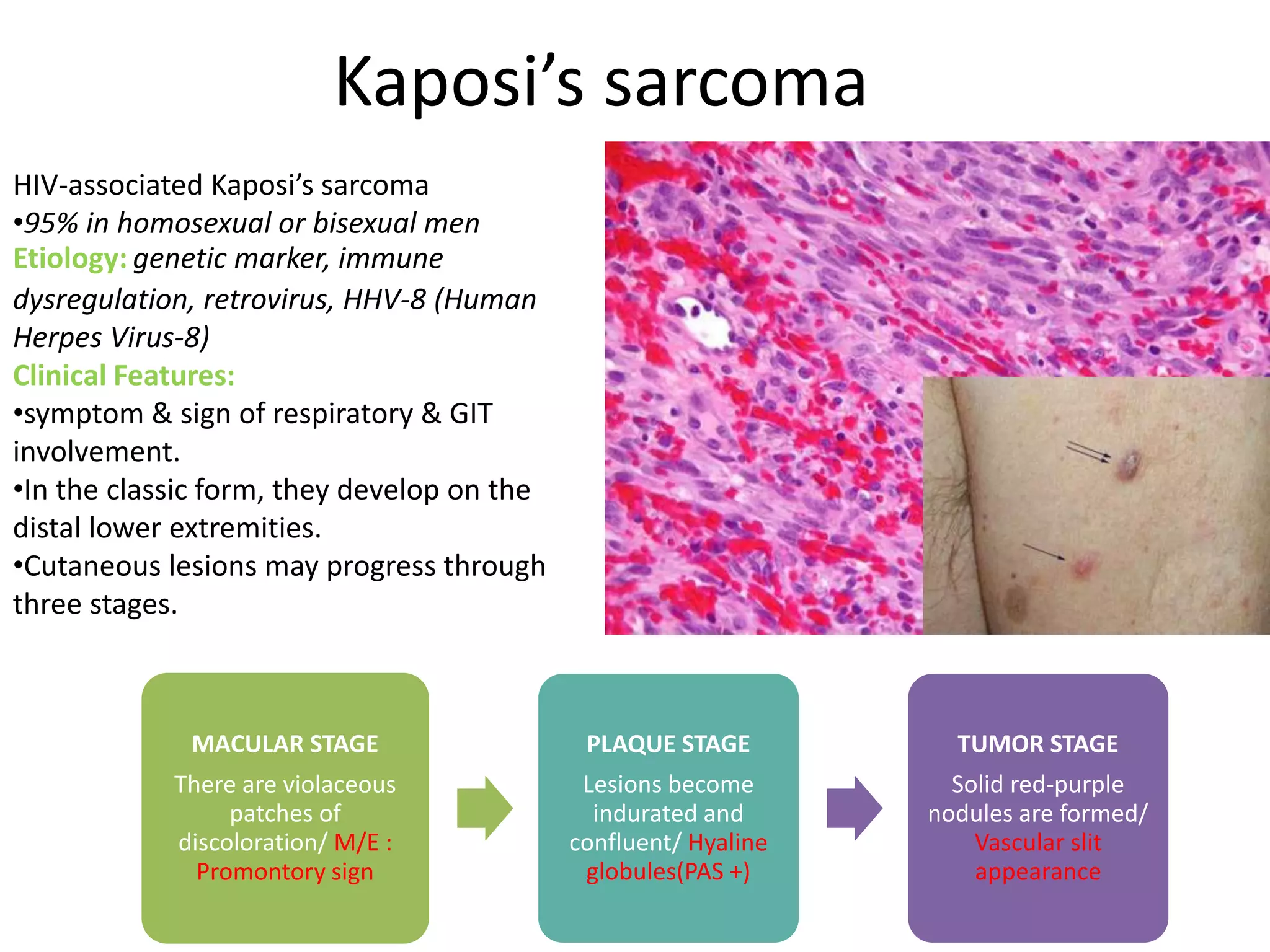 Cutaneous manifestations of hiv infection | PPTX