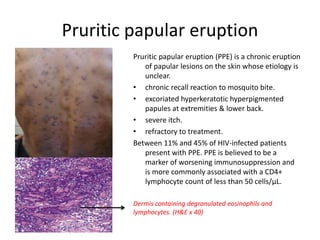 Cutaneous manifestations of hiv infection | PPTX