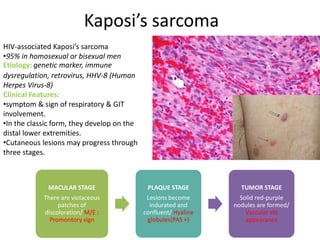 Cutaneous manifestations of hiv infection | PPTX