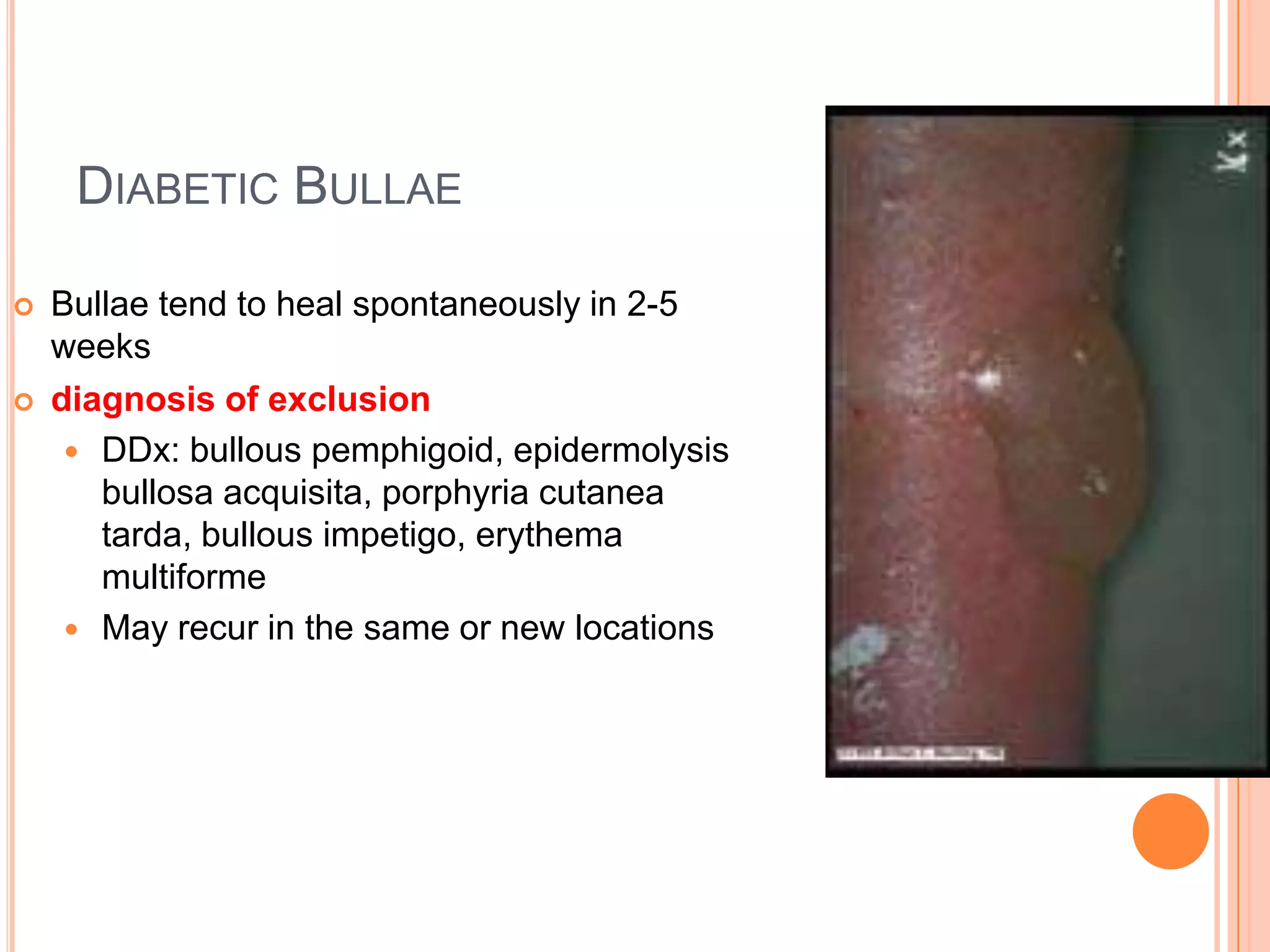 Cutaneous manifestations of internal diseases | PPTX
