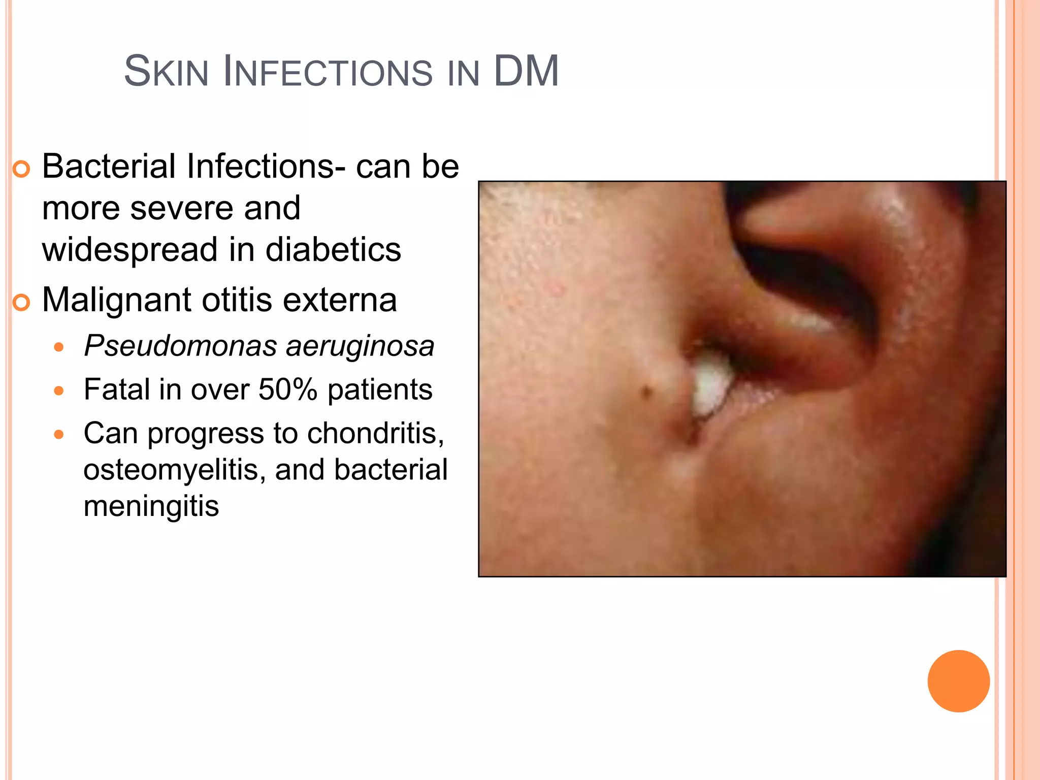 Cutaneous manifestations of internal diseases | PPTX