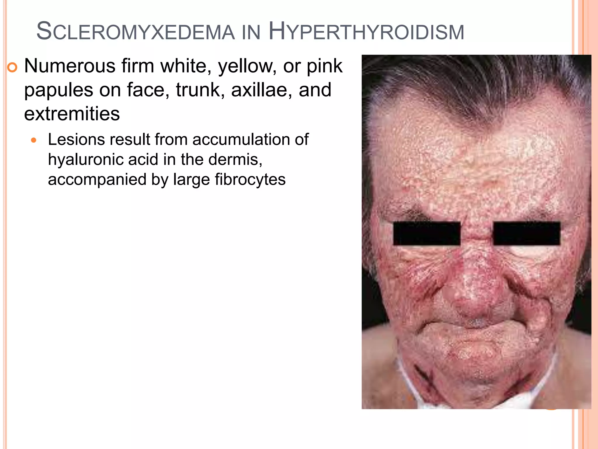 Cutaneous manifestations of internal diseases | PPTX