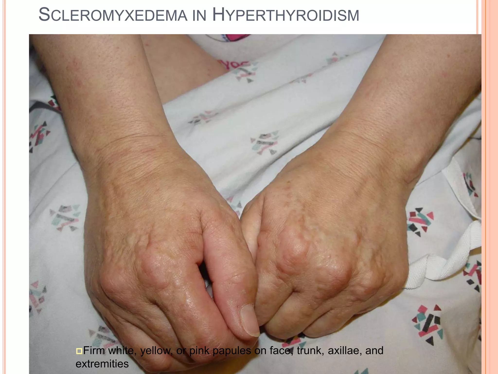 Cutaneous manifestations of internal diseases | PPTX