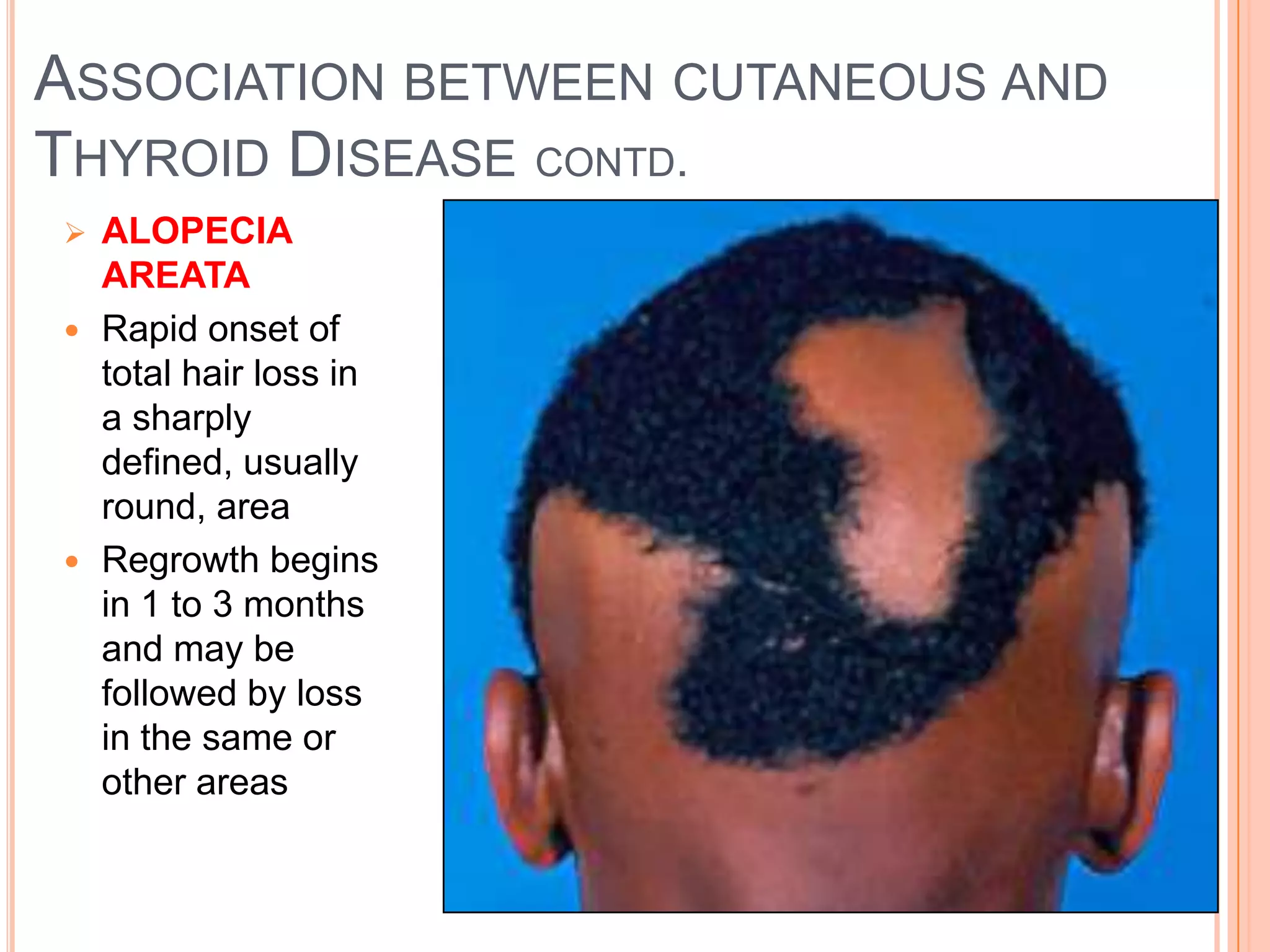 Cutaneous manifestations of internal diseases | PPTX