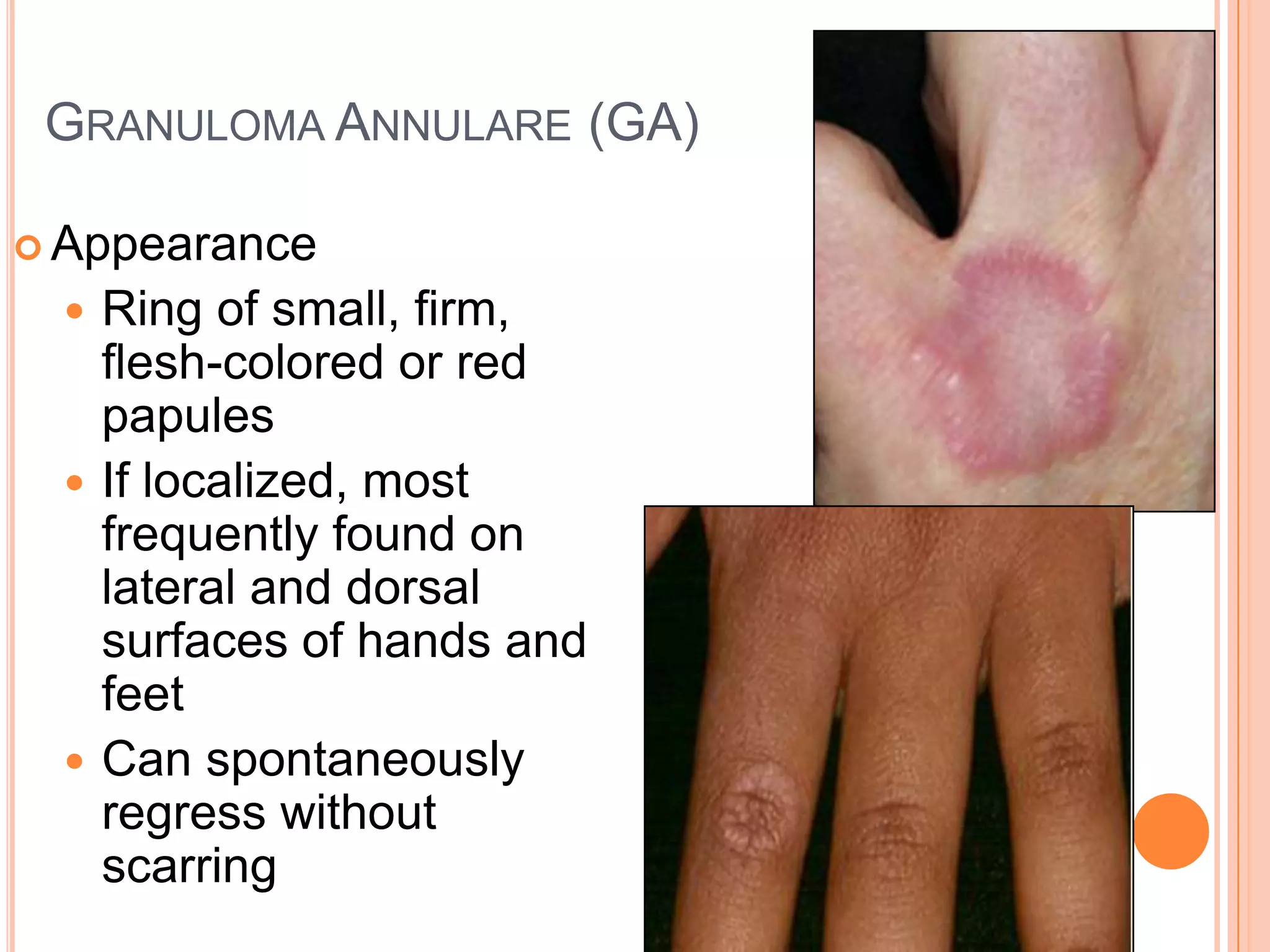 Cutaneous manifestations of internal diseases | PPTX
