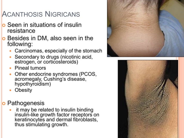 Cutaneous manifestations of internal diseases | PPTX | Thyroid ...