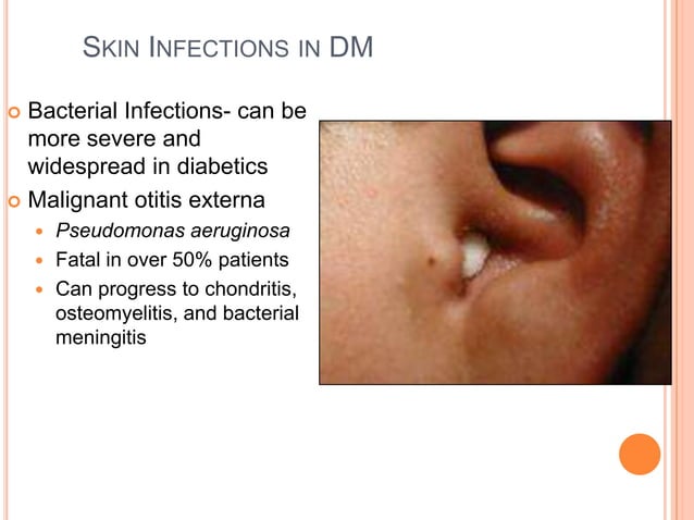 Cutaneous manifestations of internal diseases | PPTX | Thyroid ...