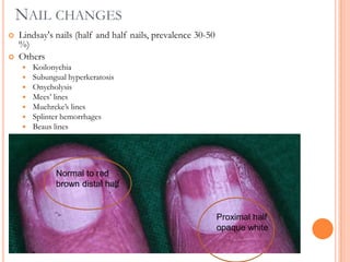 Cutaneous manifestations of internal diseases | PPTX