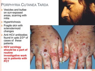 Cutaneous manifestations of internal diseases | PPTX