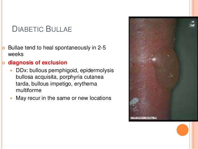 Cutaneous manifestations of internal diseases