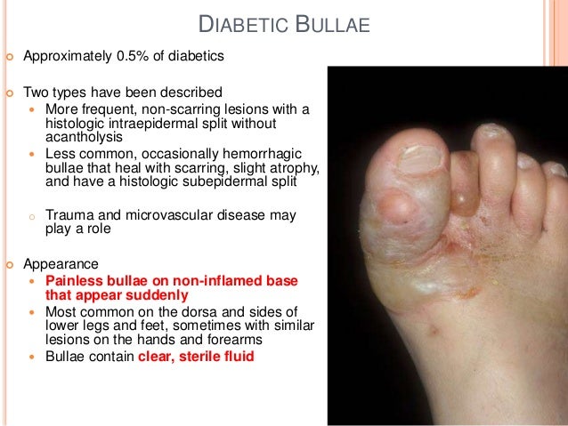 Cutaneous manifestations of internal diseases