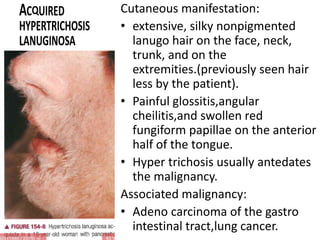 Cutaneous manifestations of internal malignancies. | PPTX