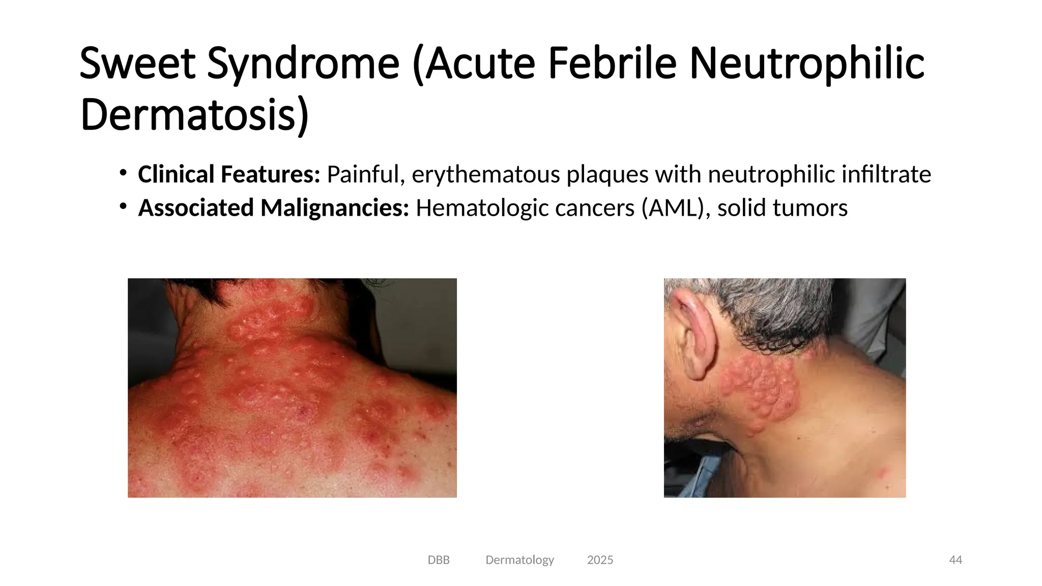 cutaneous manifestations of internal malignancies.pptx