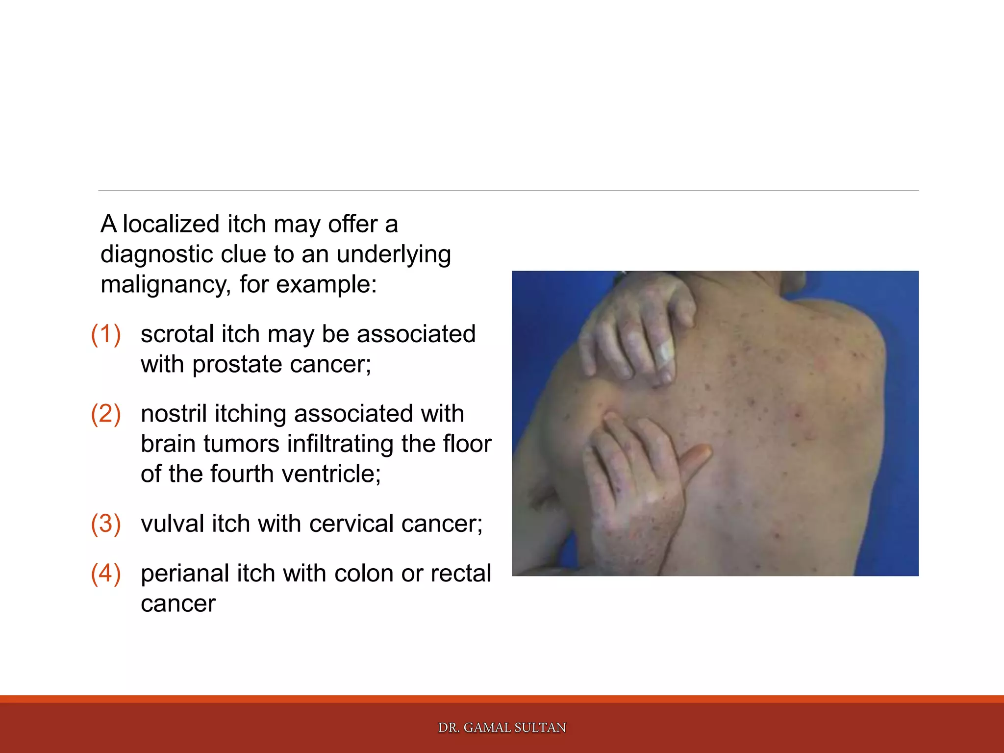 Cutaneous manifestations of internal malignancy and paraneoplastic ...