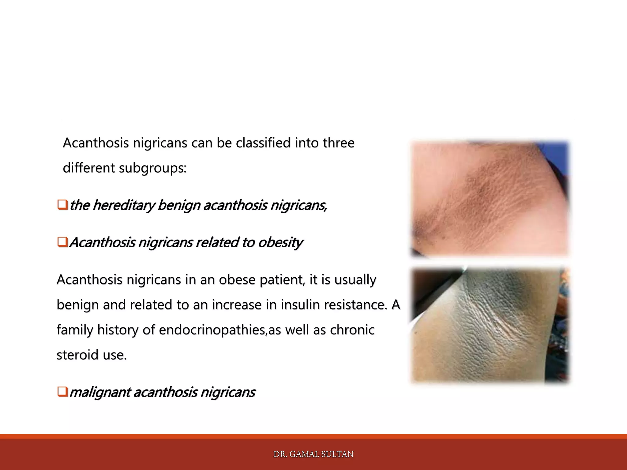 Cutaneous manifestations of internal malignancy and paraneoplastic ...
