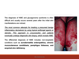 Cutaneous manifestations of internal malignancy and paraneoplastic ...