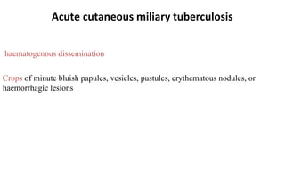 Cutaneous manifestations of tb | PPT