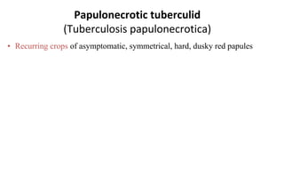 Cutaneous manifestations of tb | PPT